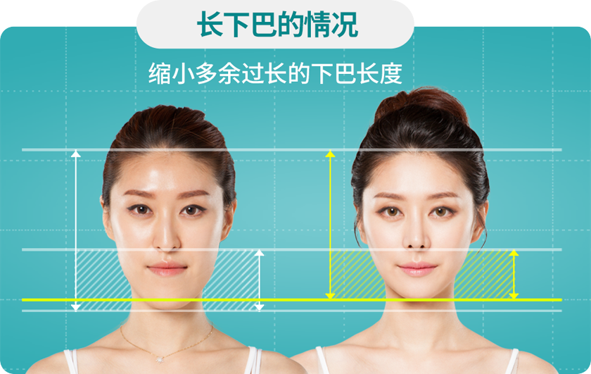 bg-face-diavline-2-1 - IDHOSPITAL