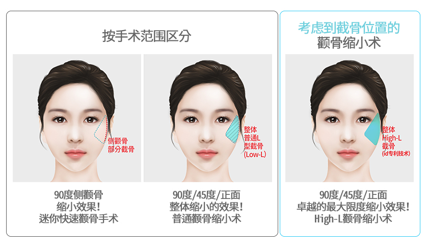 bg-face-high-L-2 - IDHOSPITAL