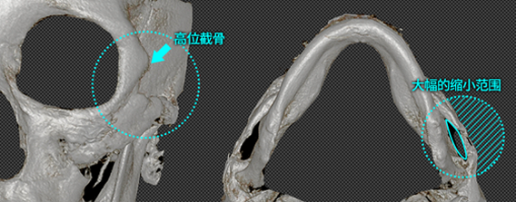bg-face-high-L-5-4 - IDHOSPITAL