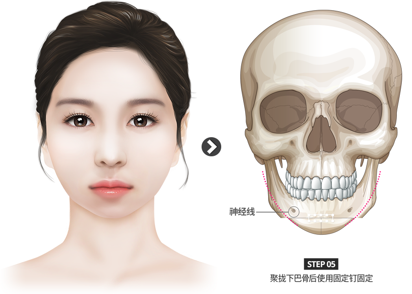 bg-face-minivline-7-5 - IDHOSPITAL