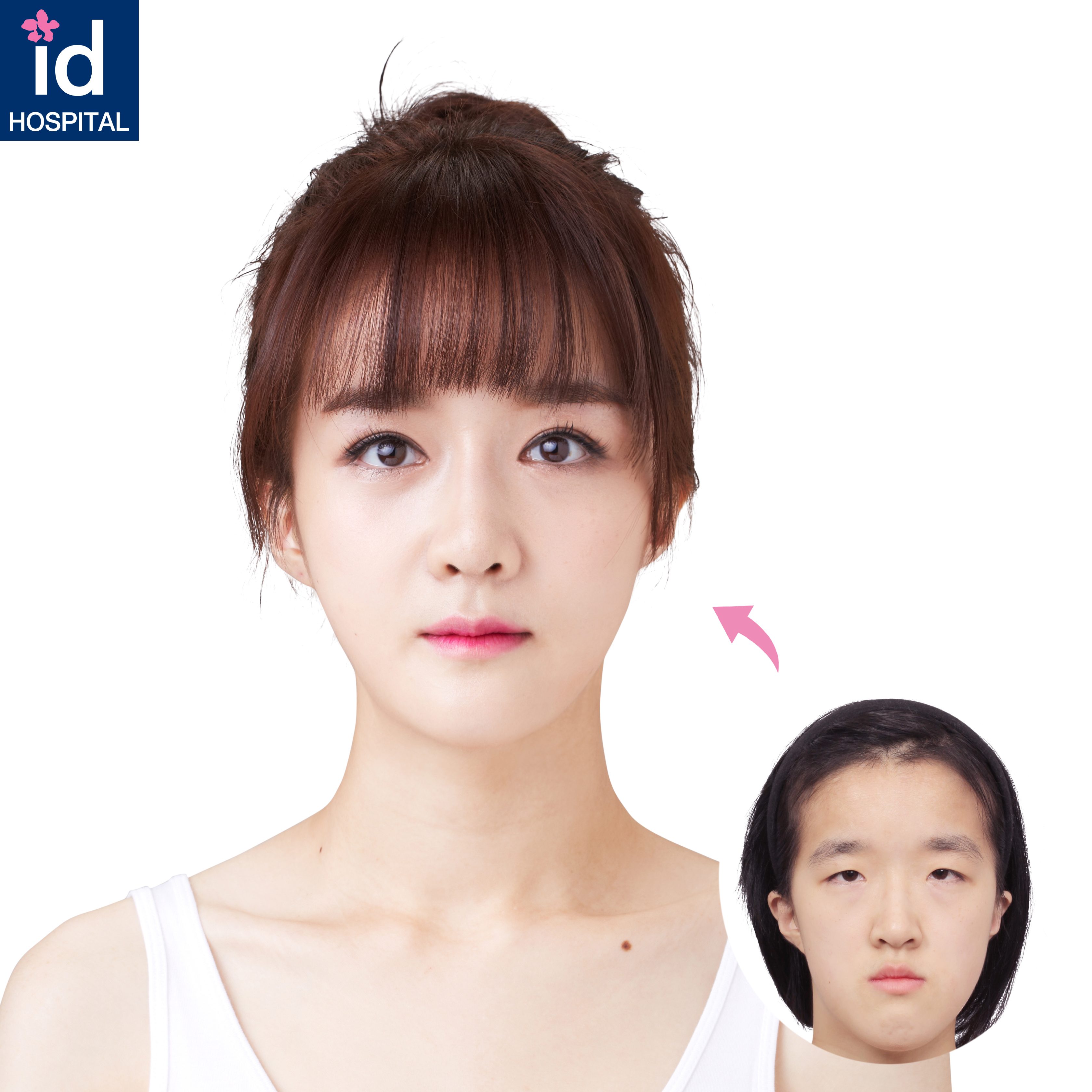 These transformations are real. ID's real plastic surgery makeover ...