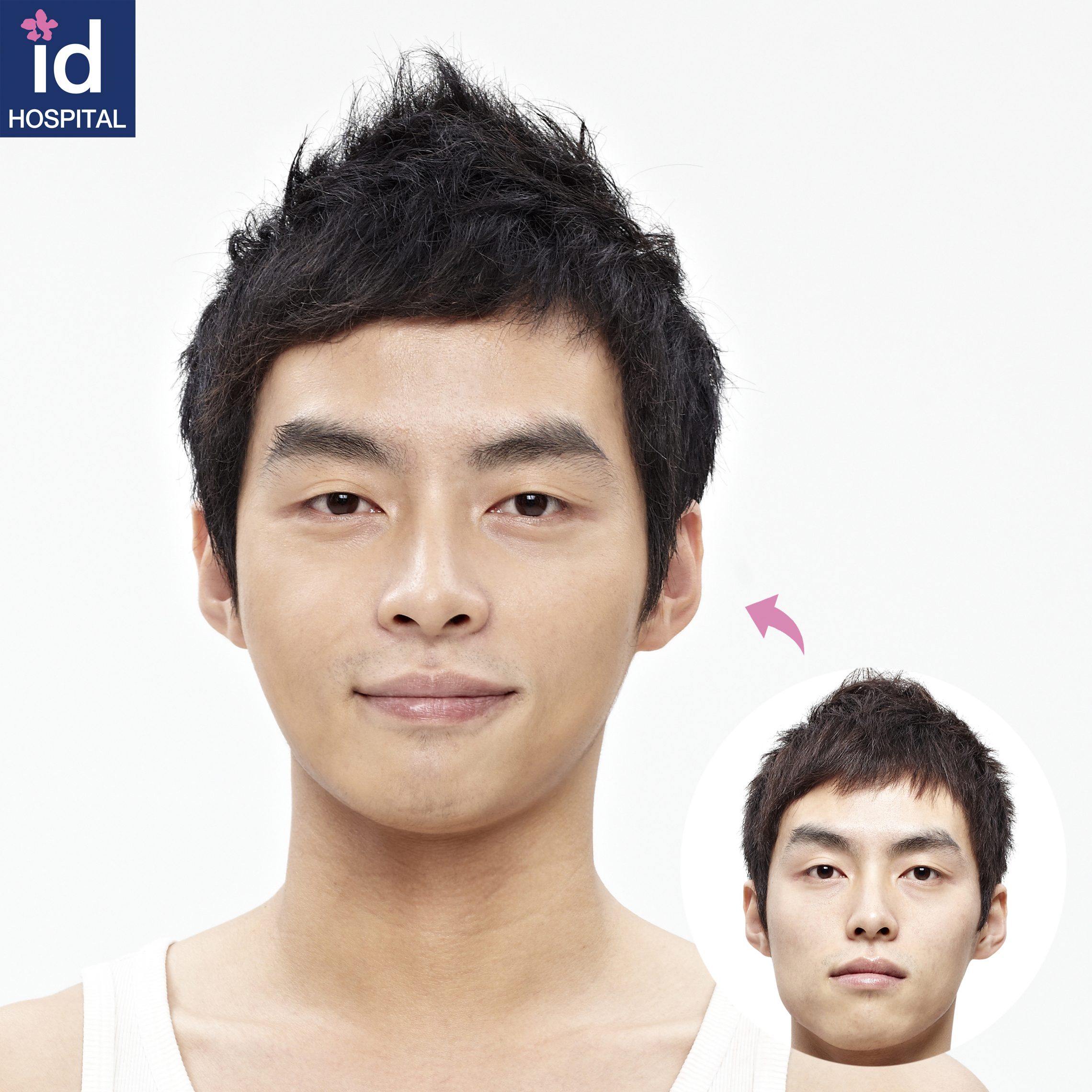 These transformations are real. ID's real plastic surgery makeover ...